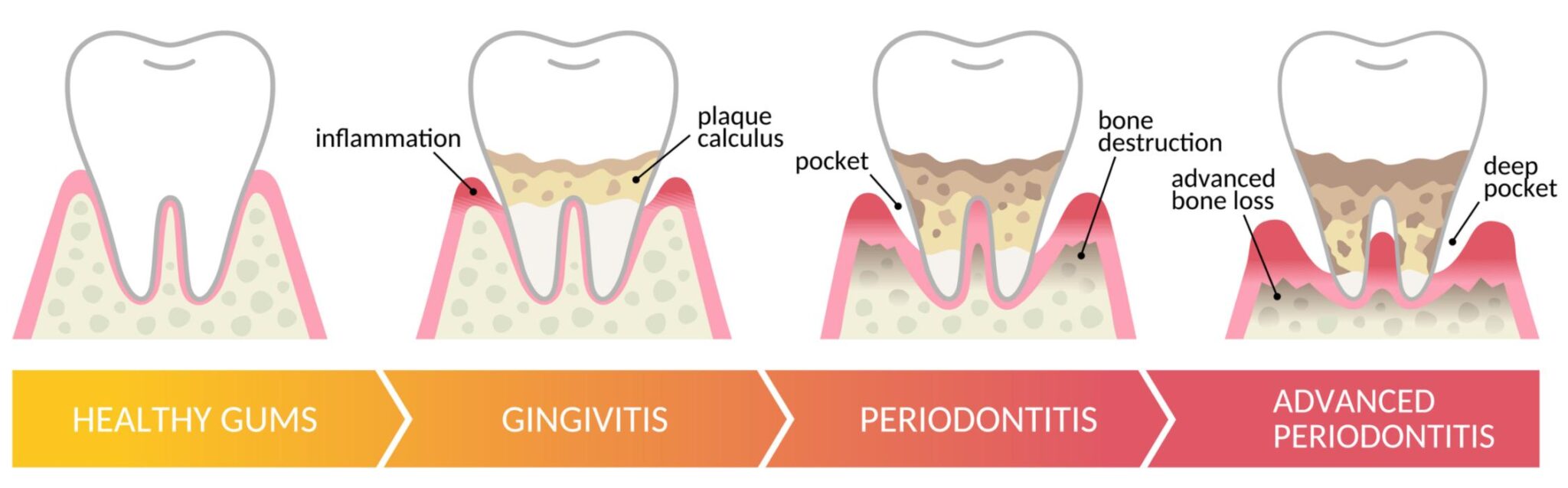 Guide to Periodontal Diseases by Dental Park